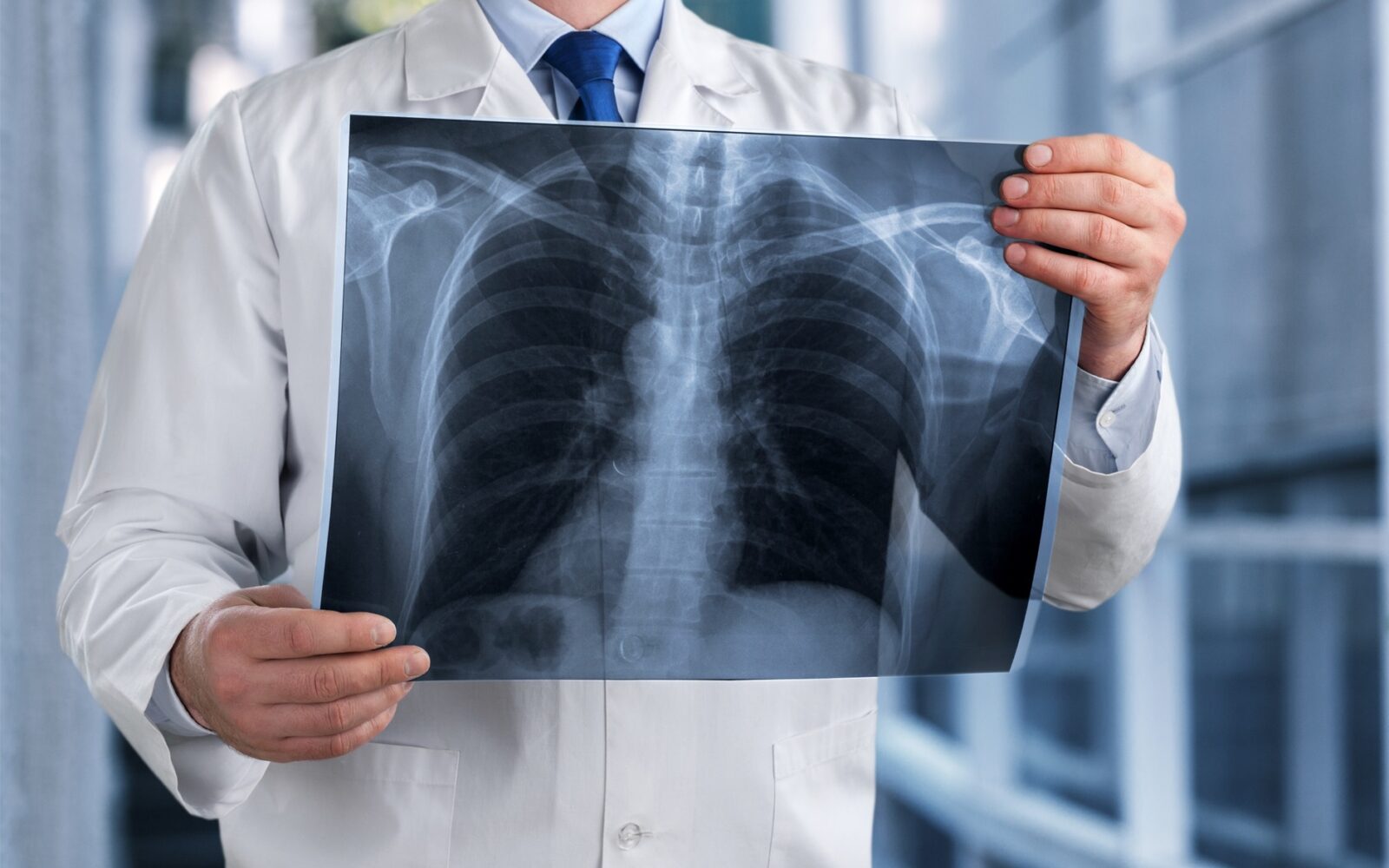 Chest X-Ray 2025
